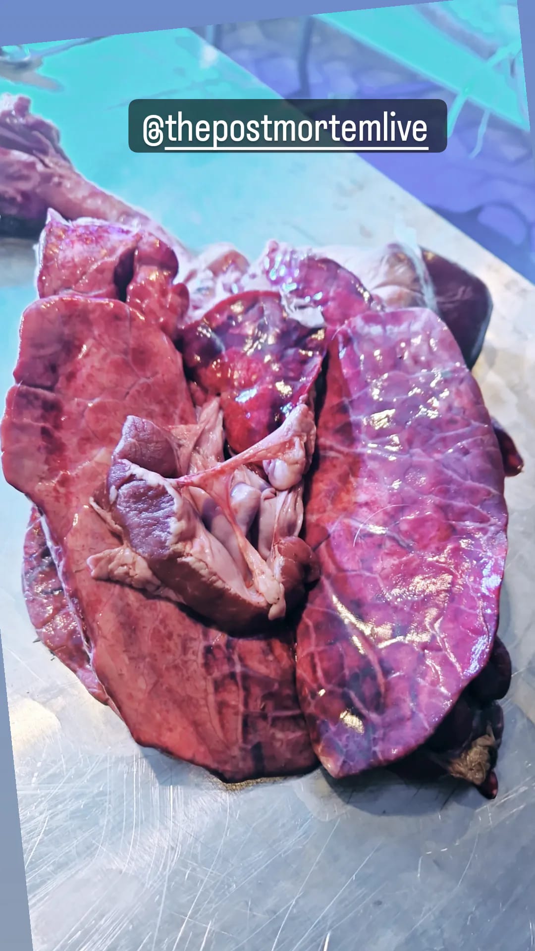 LIVE CANNIBALISM SHOWS: Post Mortem Live – The Cannibal Guy